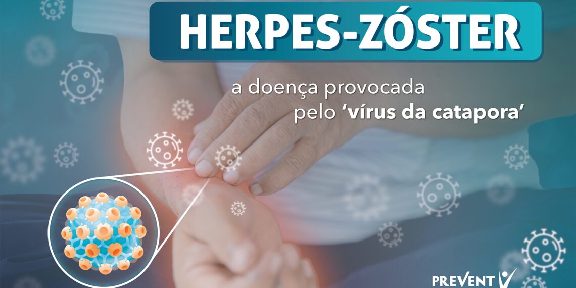 Os sinais da Herpes-Zóster no Adulto+ | Vida & Tal